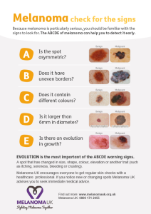 Melanoma - NHS Gateshead Health